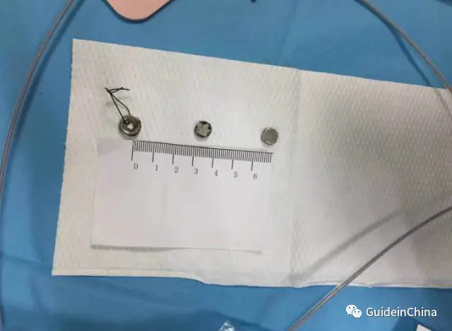 Chinese Doctors Quick Thinking Saves Boys Stomach - hiredchina.com Chinese Doctors Quick Thinking Saves Boys Stomach - hiredchina.com
